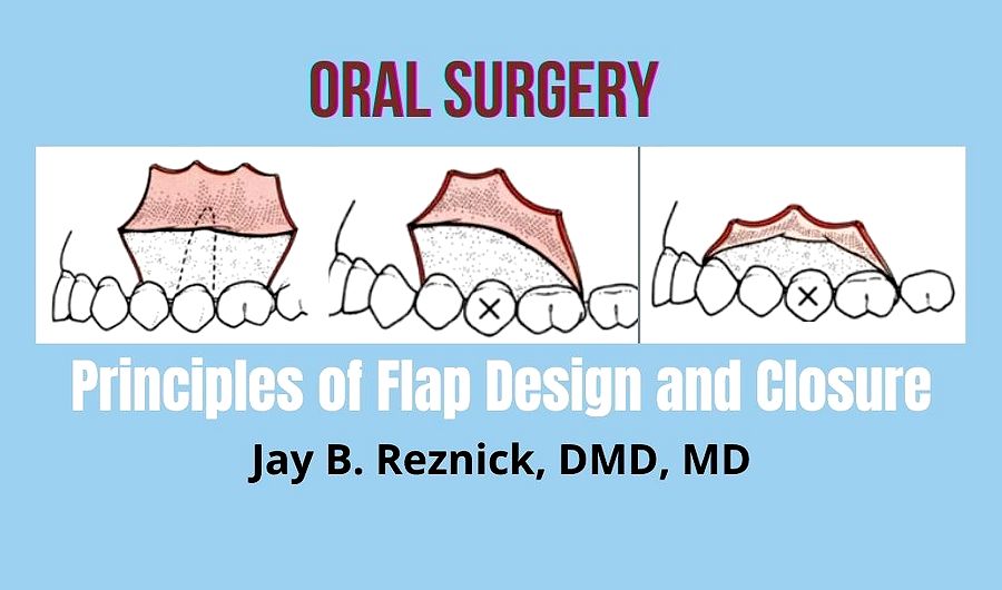 Pdf Principles Of Flap Design And Closure Oral Surgery Jay B