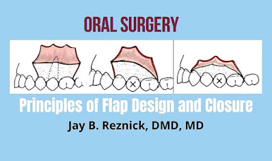 PDF: Principles of Flap Design and Closure - Oral Surgery - Jay B ...
