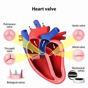 Prosthetic Heart Valves
