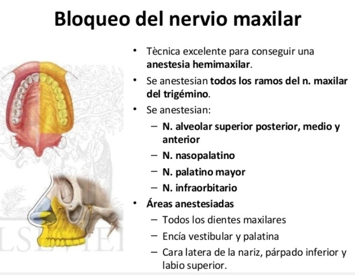 Caso Clínico Periodoncia