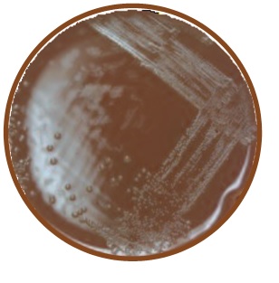 [Microbiology] Chocolate II Agar | Free Medical Atlas