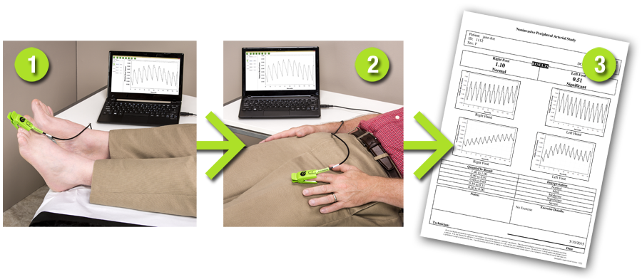 John Hildebrant: QUANTAFLO™ Peripheral Arterial Disease Test