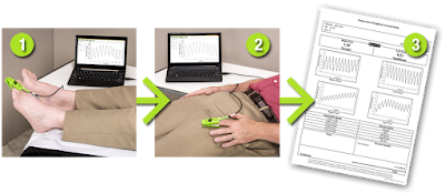 John Hildebrant: QUANTAFLO™ Peripheral Arterial Disease Test