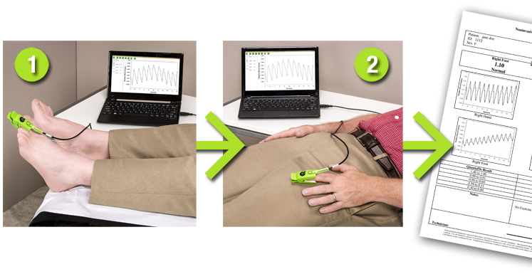 John Hildebrant: QUANTAFLO™ Peripheral Arterial Disease Test