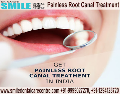 Painless Root Canal Treatment And Benefits of It