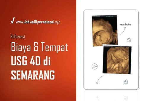 10 Tempat USG 4D di Semarang, Mulai 200rb an saja loh! - JadwalOperasional