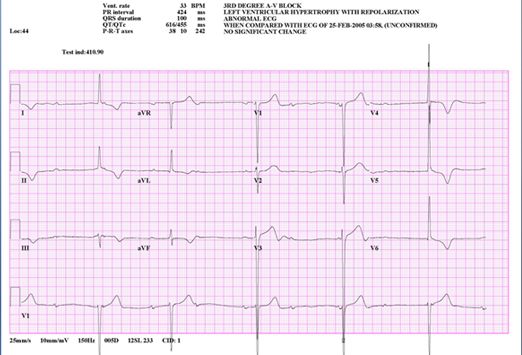 World's Tragic In Medlife,.....You May Know Or Not: Strange Skin ...