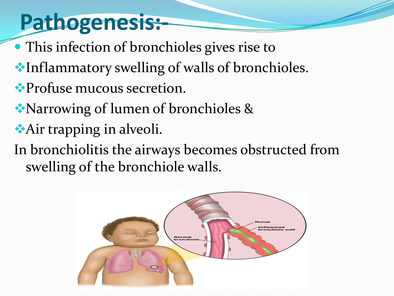 Do you want to know Bronchiolitis easily? - Learn knowledge and Spread knowledge