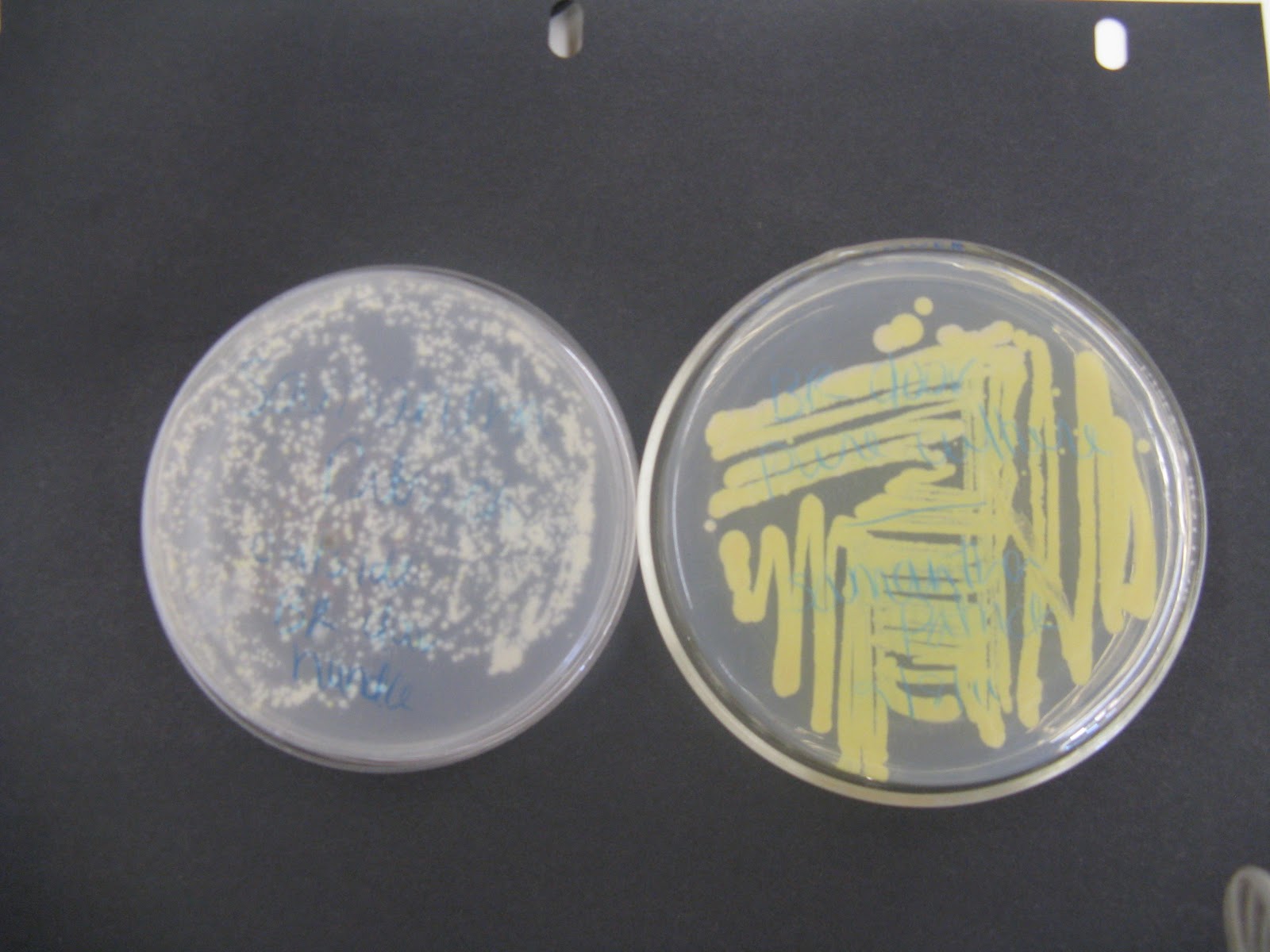 Samantha and Sarah's Microbiology Lab Journal: Staining Bacteria ...