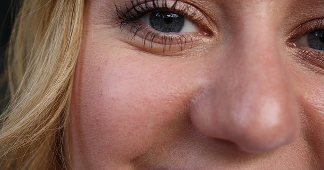 How To Remove Wrinkles Around Mouth And Lips Tips And Remedies To Get