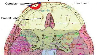 TDCS-Transcranial-Direct-Current: Combining TDCs with fNIRS ...