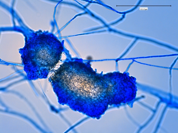 Fun With Microbiology (What's Buggin' You?): Phoma glomerata