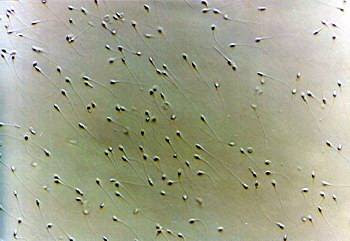 CON FINAL FELIZ: necrozoospermia