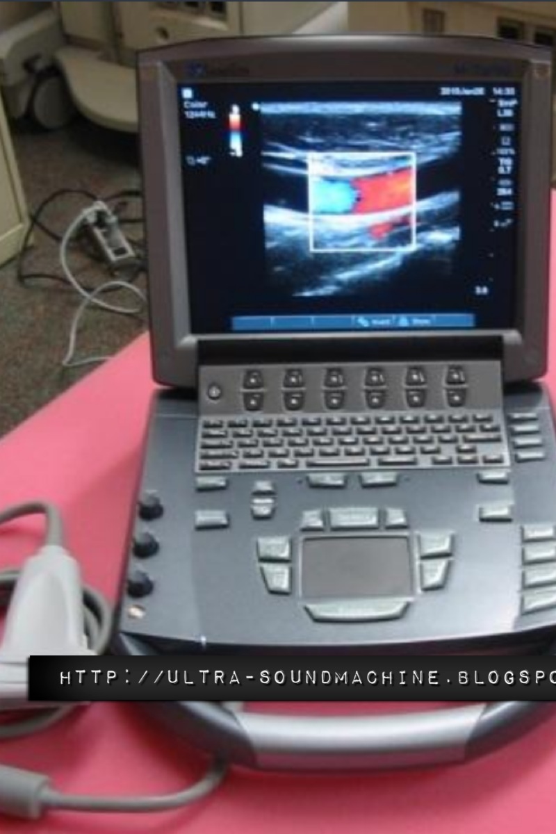 Ultra Sound Machine: Sonosite M-Turbo Ultrasound Machine