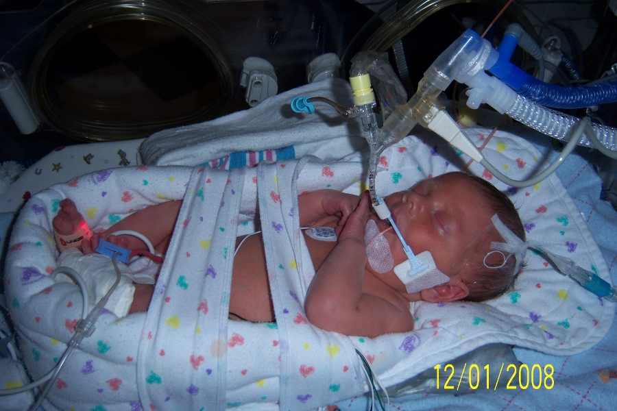 Congenital Diaphragmatic Hernia: Daily CDH Vote Reminder - Meet Cherub ...