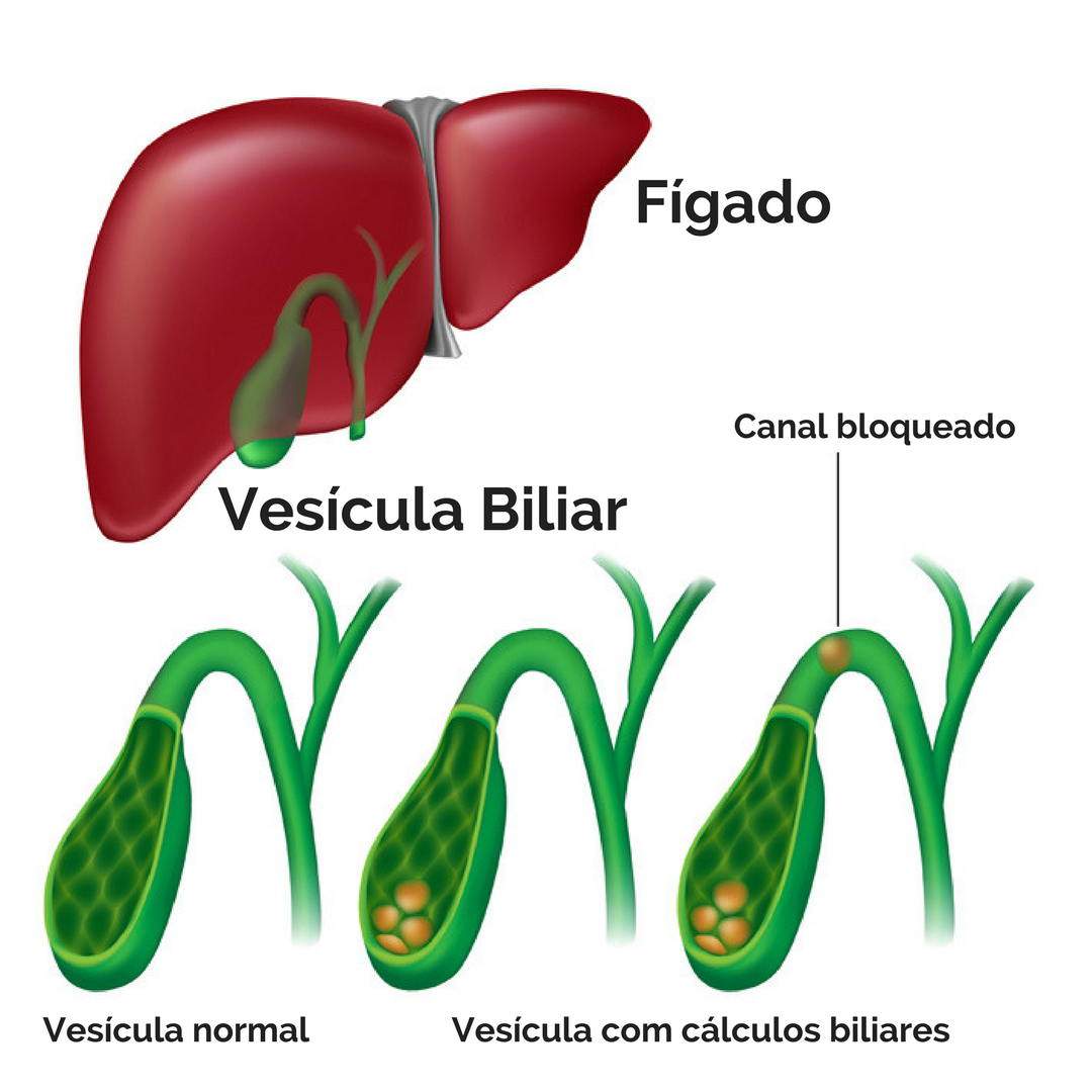 Anatomia Vesicula Biliar Ebook Download - vrogue.co Anatomia Vesicula Biliar Ebook Download - vrogue.co