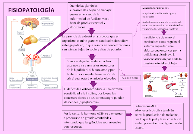ENFERMEDAD ADDISON : ENFERMEDAD ADDISON