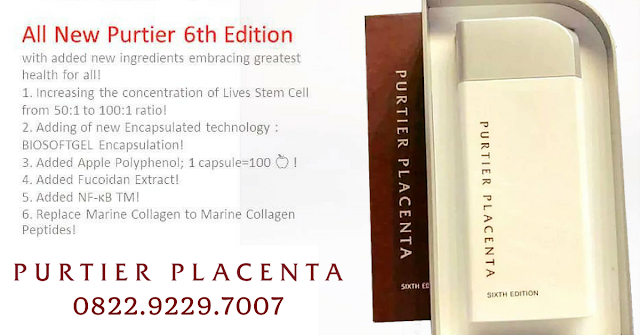 Purtier Placenta Riway