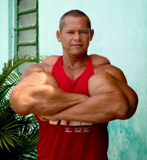 Injected Motor Oil Into Biceps at Tayla Sligo blog