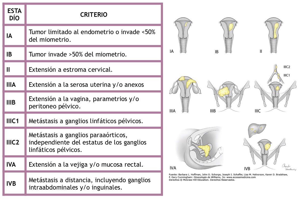 ENFERMERÍA DE LA MUJER 2019-20: CÁNCER DE ENDOMETRIO: EL GRAN DESCONOCIDO