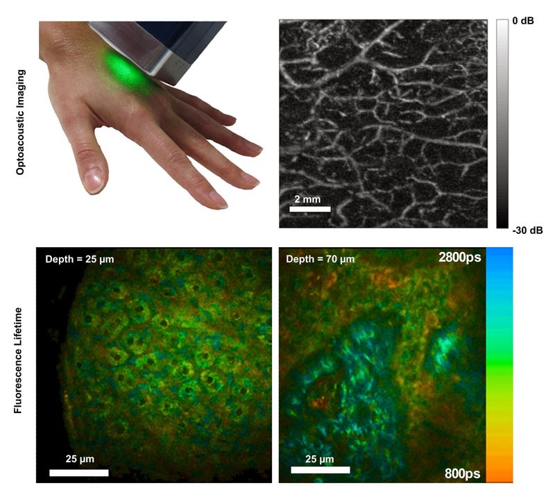 DermaNest: "SKINSPECTION" – Hybrid Imaging for Skin Diagnosis