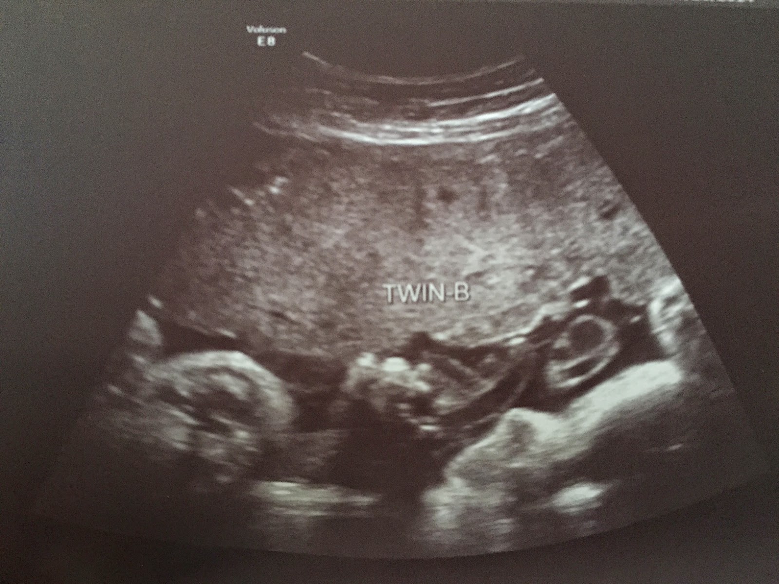 monkey and momo: my last ultrasound