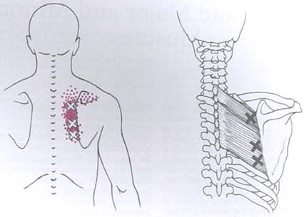 KO Performance: Addressing Tension and Tissue Quality - Part 2