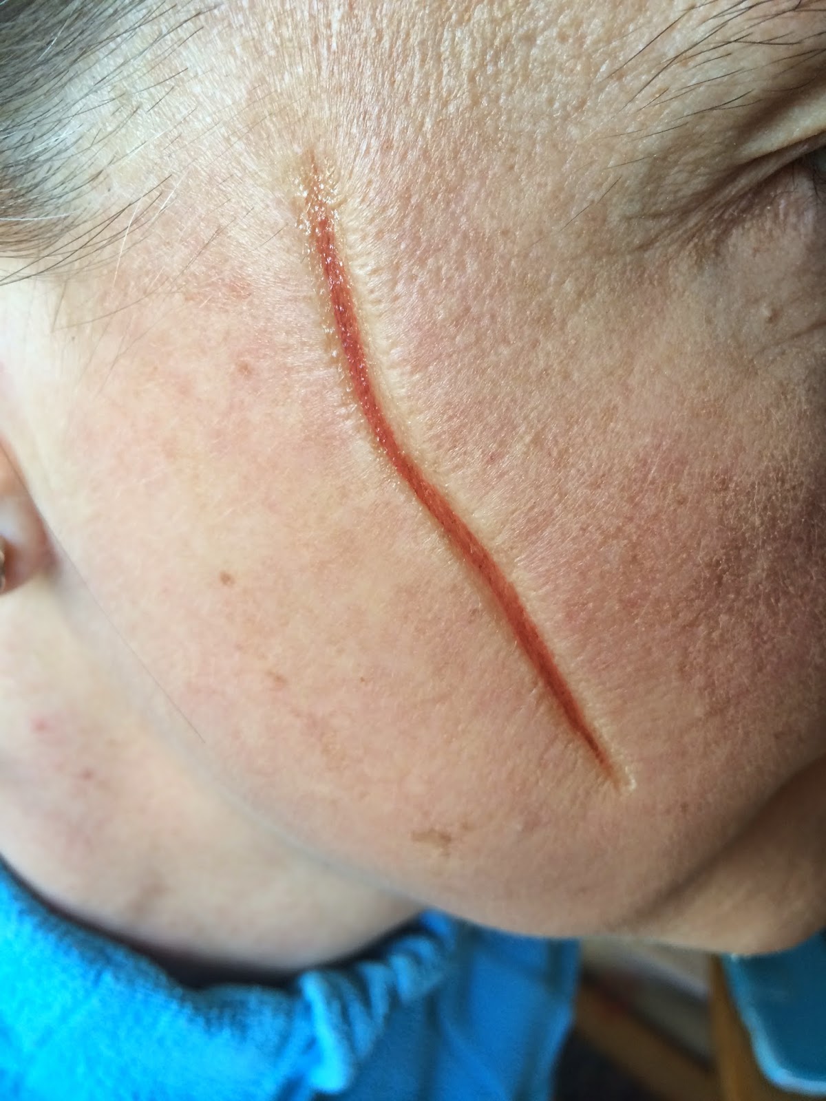 Gothic Horror: Experimenting with Claudia's Scars