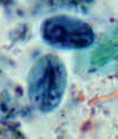 Giardioza (Lamblioza) – Psie Diety