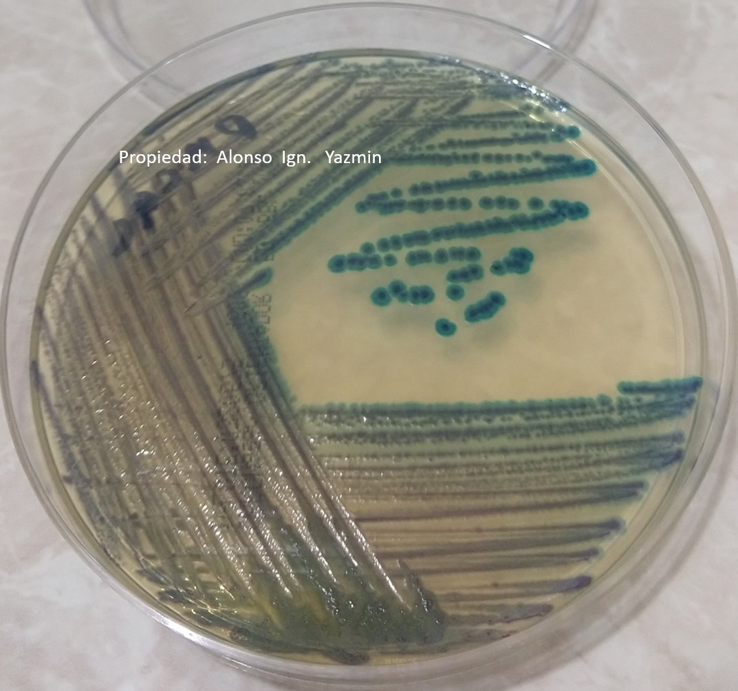 Bioquímica Diagnóstica BQD-YAI: Aeromonas hydrophila