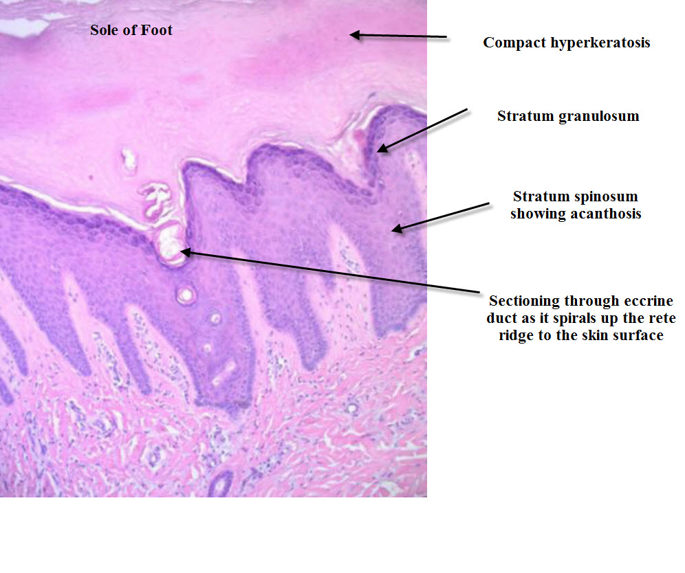 Dermatopathology Made Simple - Inflammatory: Introduction to skin ...