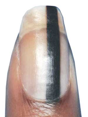 Melanonychia Handbook or How to Overcome Melanonychia - Remedy Land