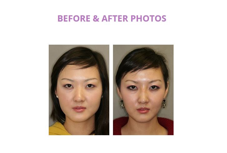 Get the best skin treatment - Guam Dermatology | Guam Dermal Clinic