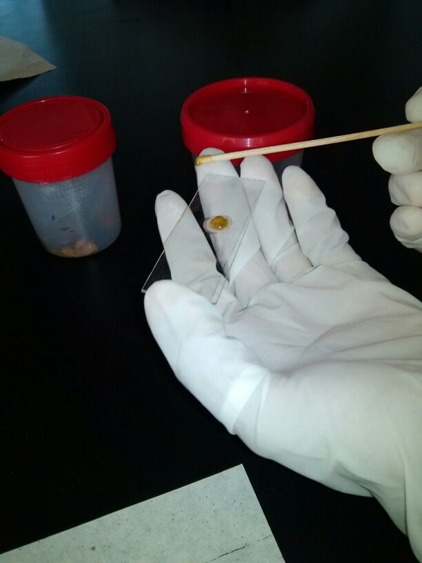 Parasitologia-Examen Coproparasitoscopico: abril 2019