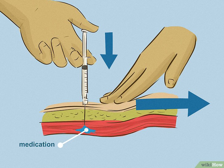 SOP INJEKSI INTRA MUSCULAR ( IM ) - Be a Nurse