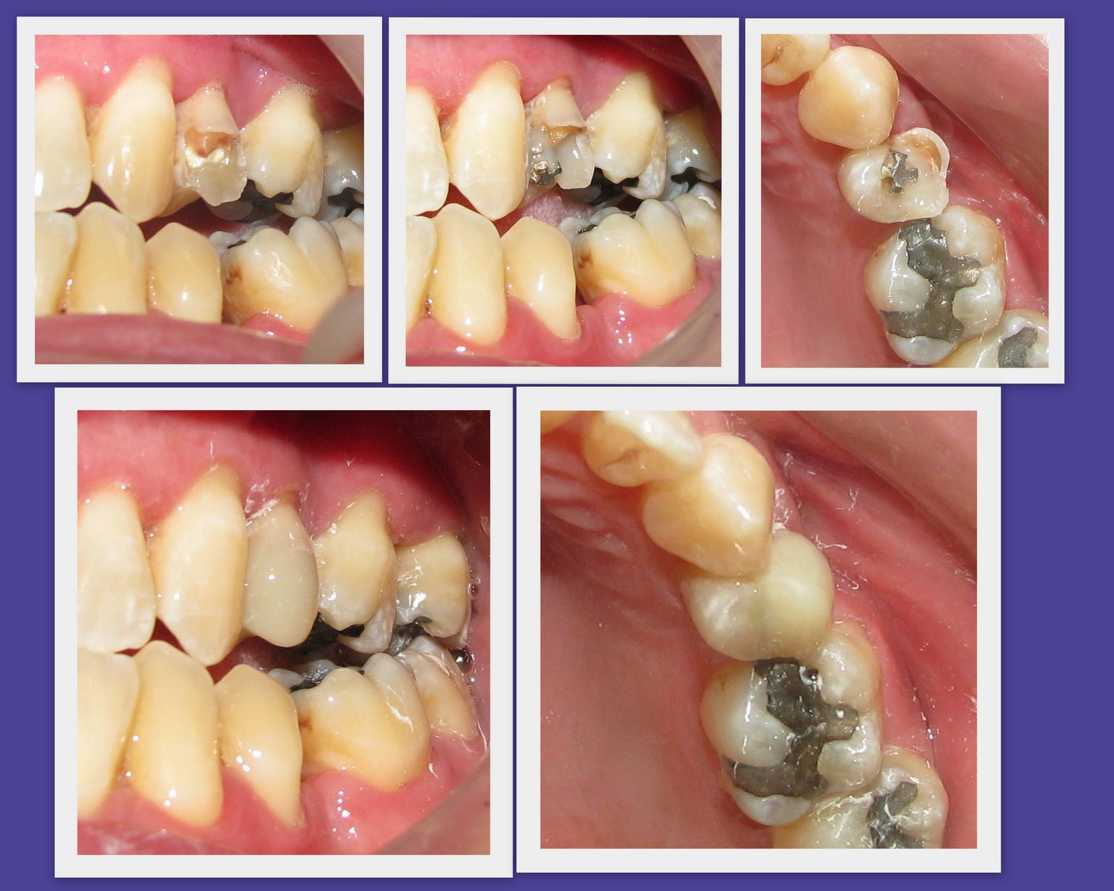 Dr. Mario Baquerizo - Dentista (Odontologia Integrada): 2012-06-17