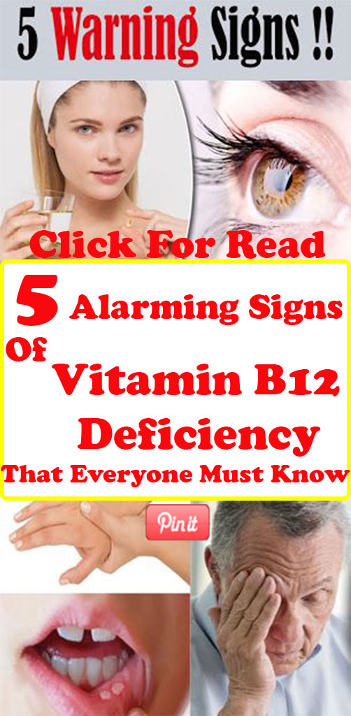 5 Alarming Signs Of Vitamin B12 Deficiency That Everyone Must Know ...