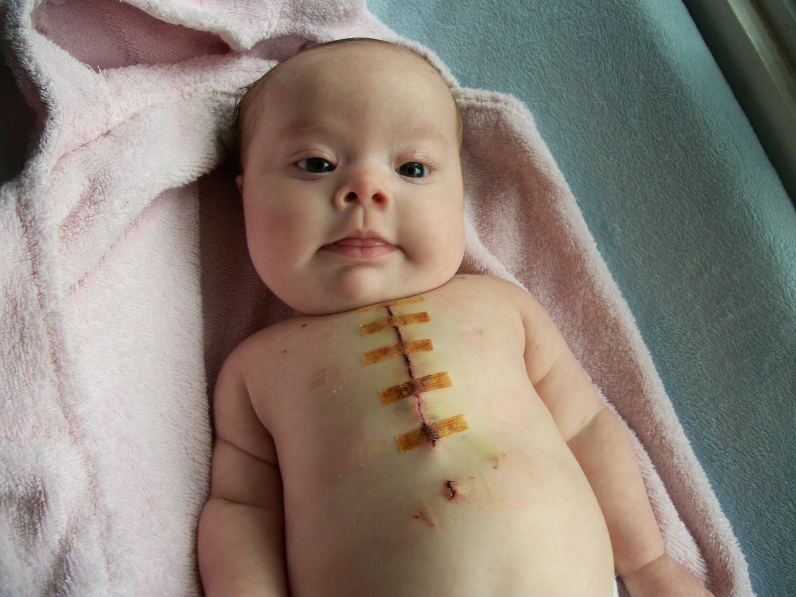 The House That Jade Built: Ollie's Open Heart Surgery