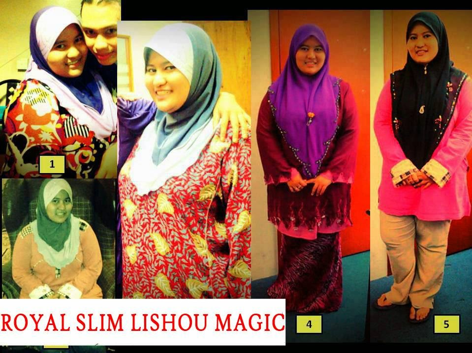 simplyaddorable: ROYAL SLIM LISHUO MAGIC