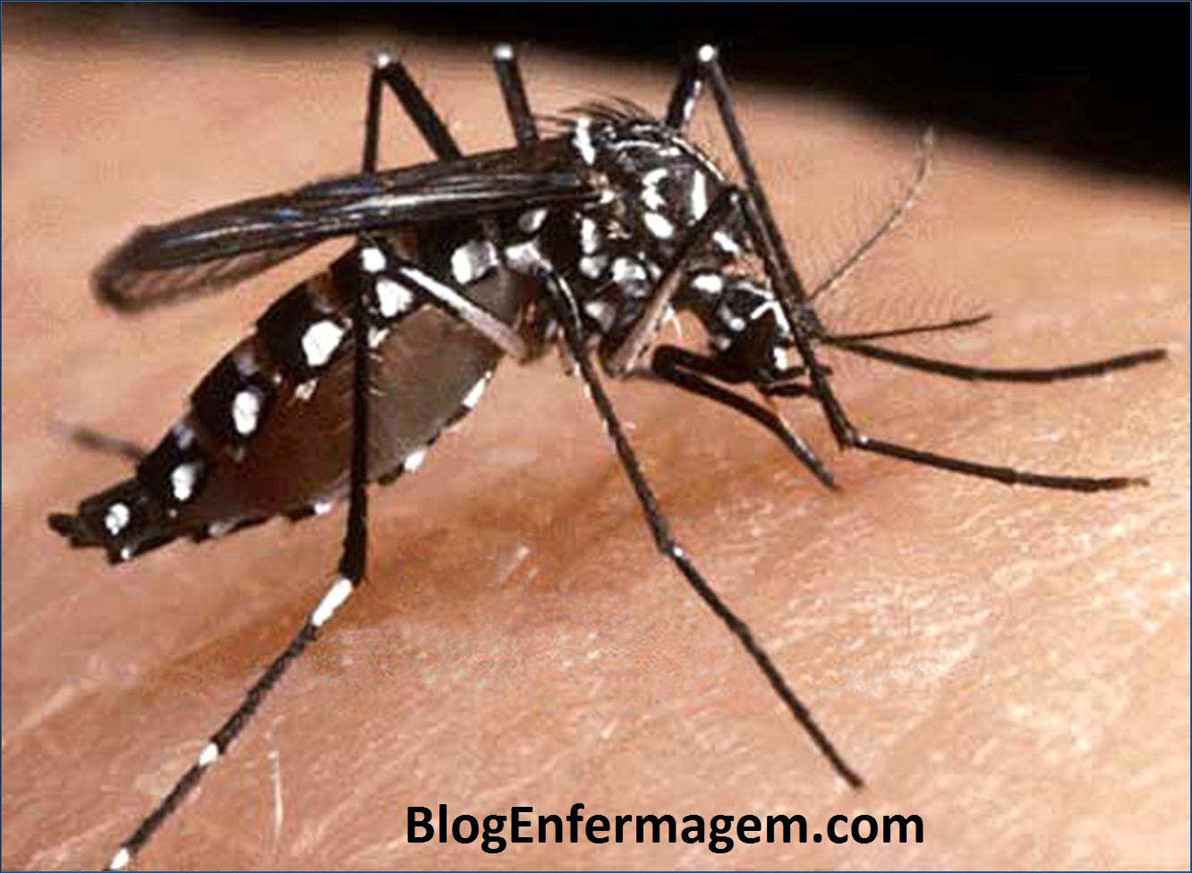 Blog Enfermagem (Original): [Resumo] Diagnostico e Tratamento da DENGUE ...