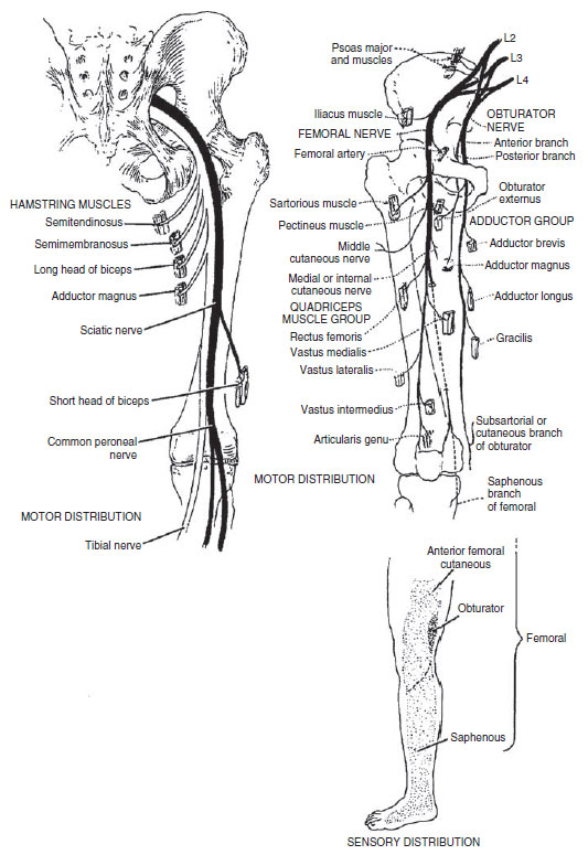Common Fibular Nerve Injury Case File