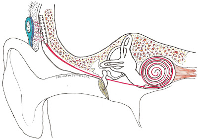 El Baúl Radiológico: IMPLANTES COCLEARES: SEGURIDAD EN RESONANCIA ...