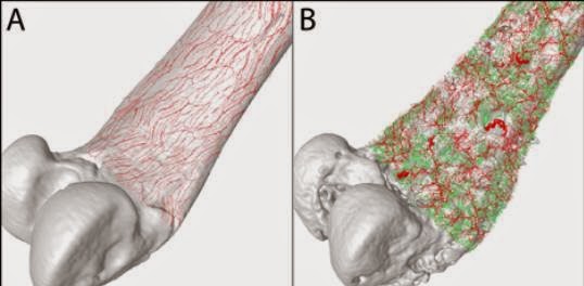 Types, Symptoms and Treatment of Bone Cancer - Education Articles