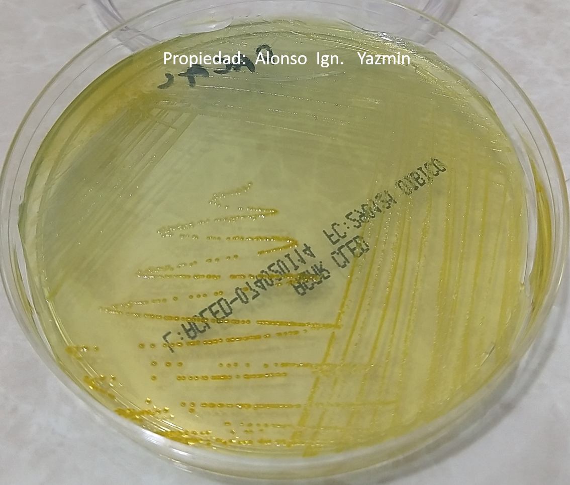 Bioquímica Diagnóstica BQD-YAI: Yersinia enterocolitica