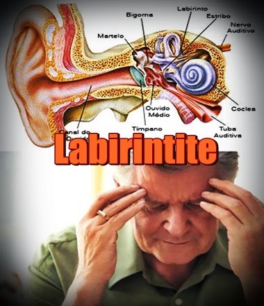 Labirintite: Causas,Sintomas e Tratamento « Bibi Mel Dicas