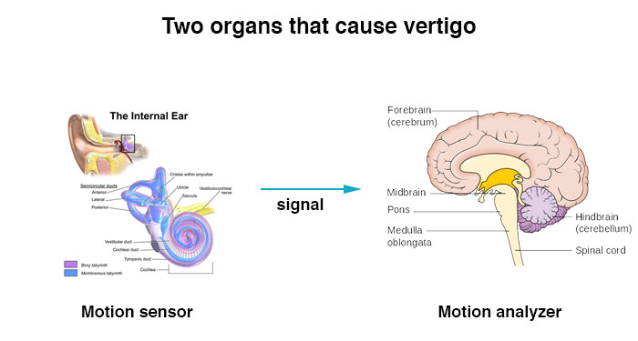 Penyakit Vertigo - Apa yang perlu kite tahu?