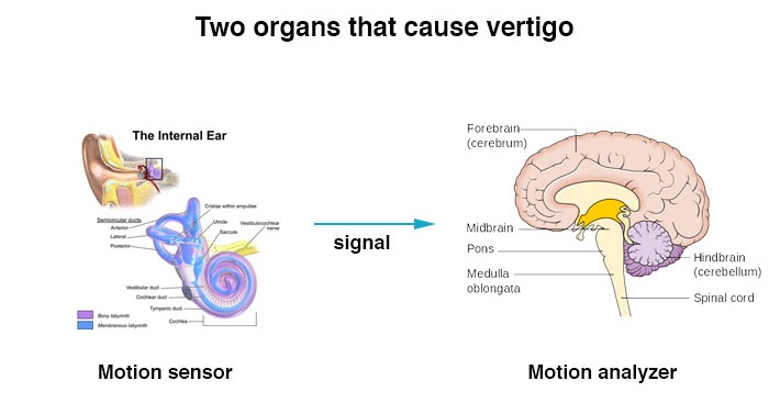 Penyakit Vertigo - Apa yang perlu kite tahu?