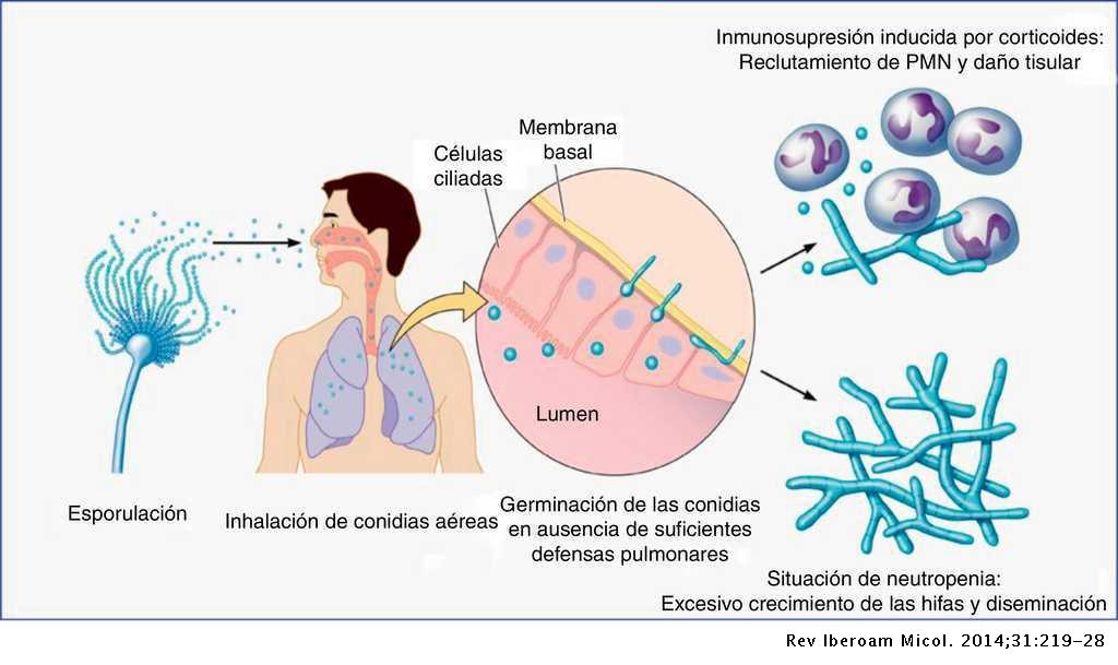 Aspergillus fumigatus