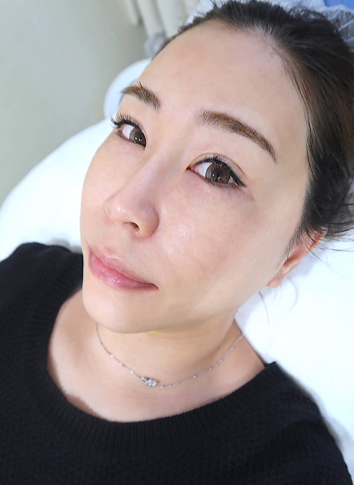 Makeup Secret: 呢個 treatment 真係好顛要試! 唔試後悔! Wiish Derma「等離子細胞再生療程」