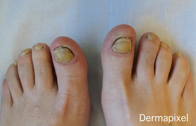 Dermapixel: junio 2021